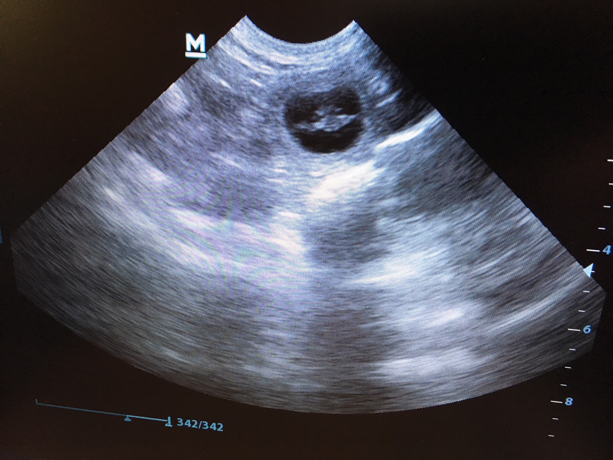 First puppy pix - fetus at 3 weeks | Teulu's Great Danes